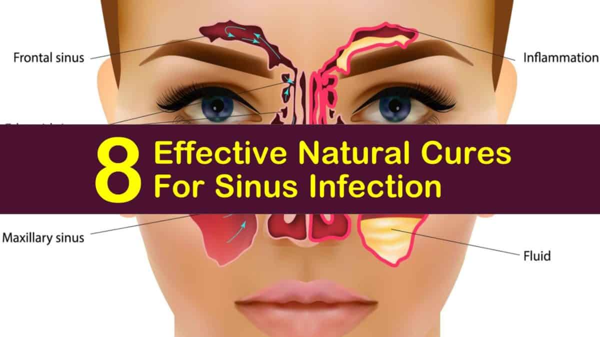 8 Effective Natural Cures For Sinus Infection